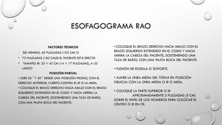 Esofagograma Contrastado Baritado (1).pptx