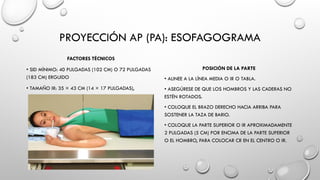 Esofagograma Contrastado Baritado (1).pptx