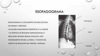 Esofagograma Contrastado Baritado (1).pptx