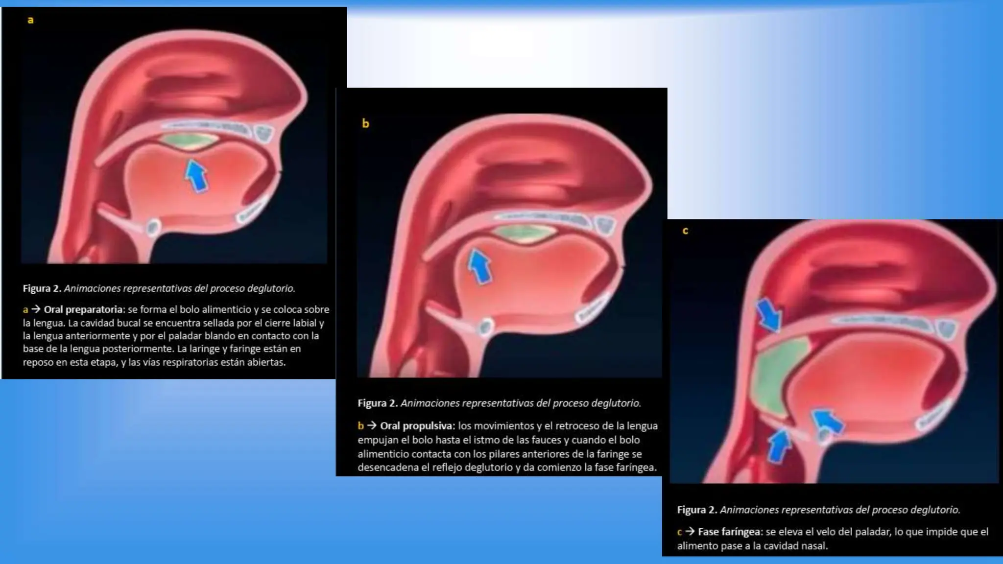 Esofagograma, técnicas, importancia, patologias | PPTX