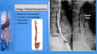 Esofagograma, técnicas, importancia, patologias | PPTX