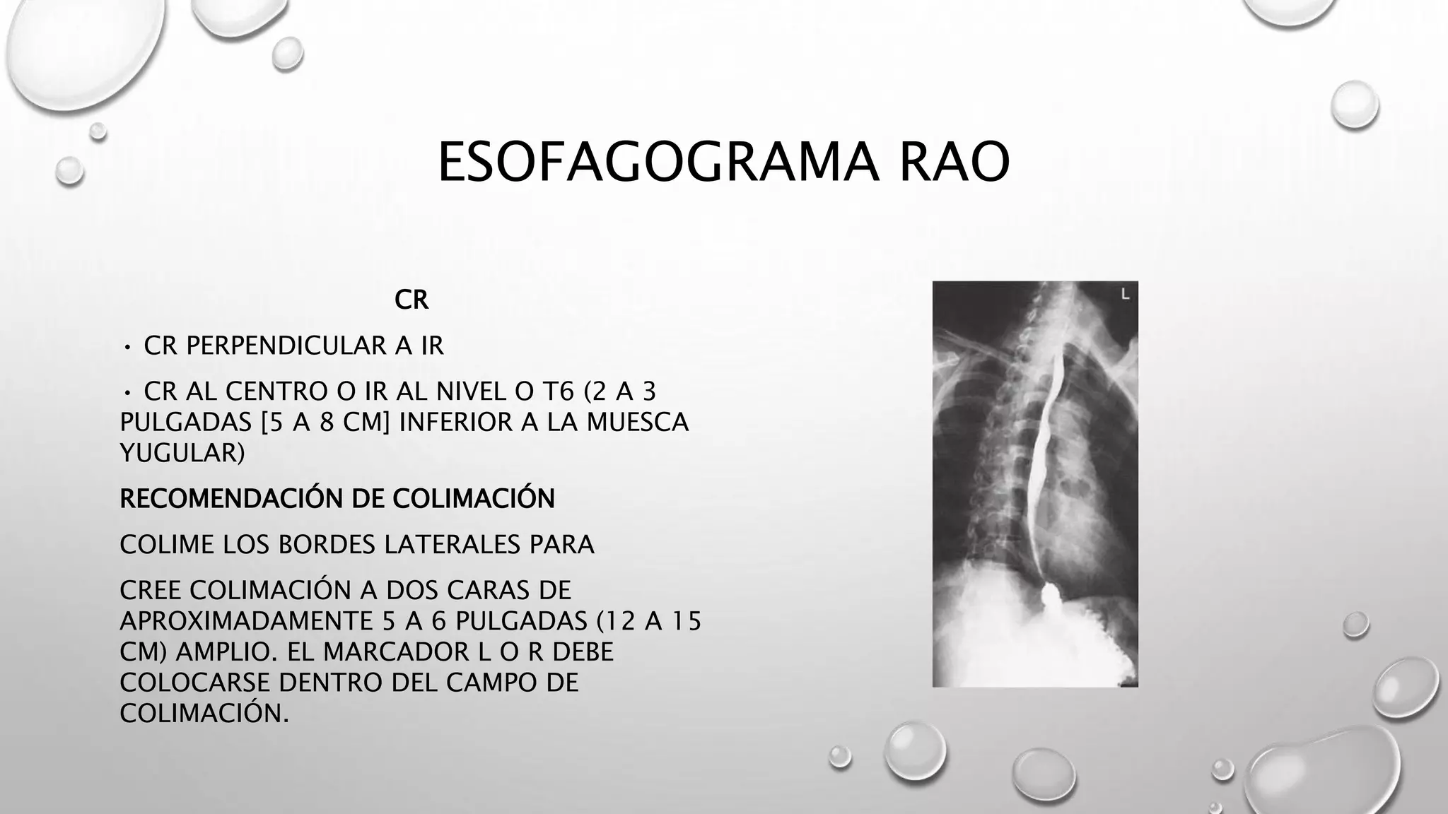 Esofagograma (bs) | PPT