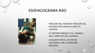 Esofagograma (bs) | PPTX