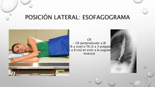 Esofagograma (bs) | PPTX