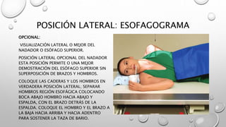 Esofagograma (bs) | PPTX