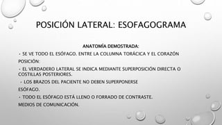Esofagograma (bs) | PPTX