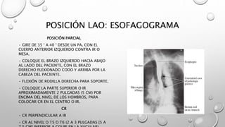 Esofagograma (bs) | PPTX