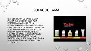 Esofagograma (bs) | PPTX
