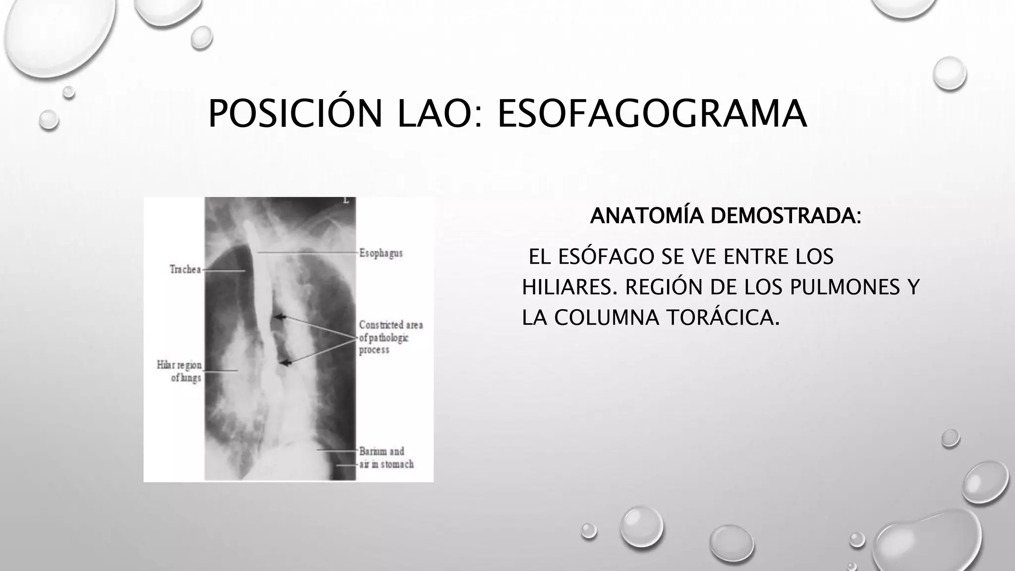 Esofagograma (bs) | PPT