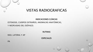 Esofagograma (bs) | PPTX