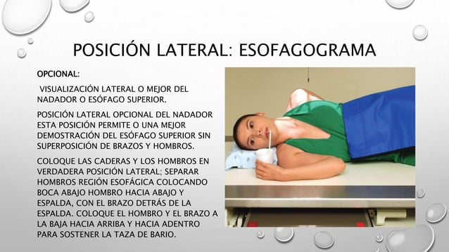 Esofagograma (bs) | PPTX