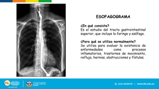 ESOFAGOGRAMA listo ya está expo1.pptx