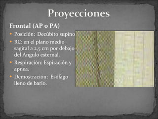 Esofagograma | PPT