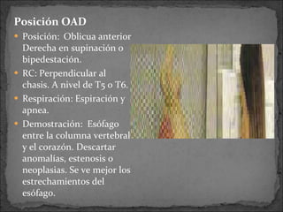 Esofagograma | PPT