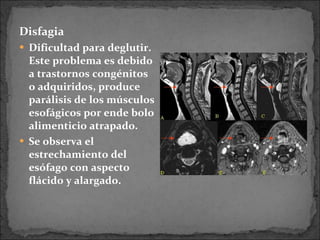 Esofagograma | PPT