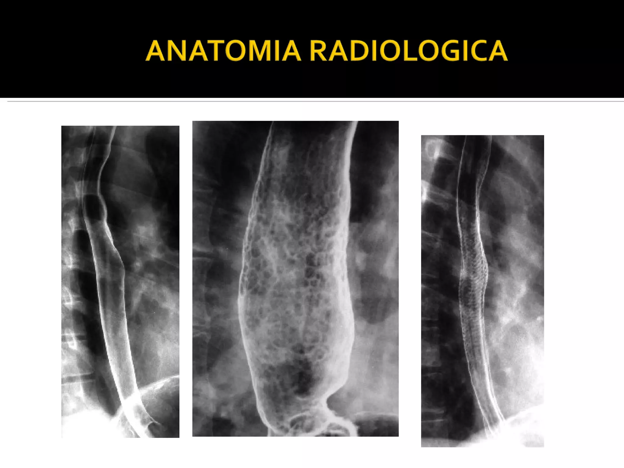 Esofagograma | PPT