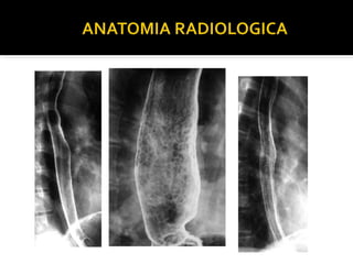 Esofagograma | PPT