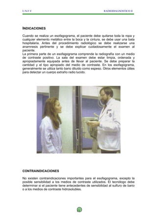 Esofagograma | DOC