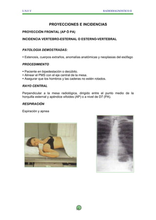 Esofagograma | DOC