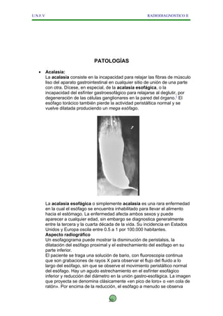 Esofagograma | DOC