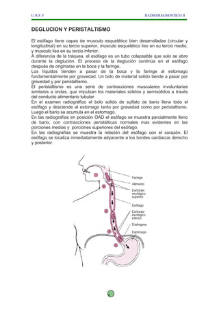 Esofagograma | DOC