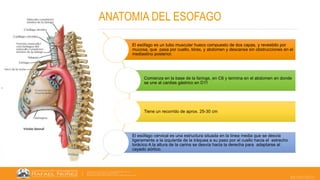 ESOFAGO PRESENTACION FINAL.pptx