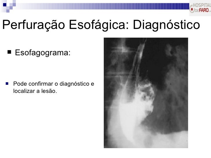 Perfuração Esofágica