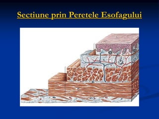 Esofagul prez veche | PPT