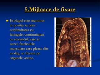 Esofagul prez veche | PPT