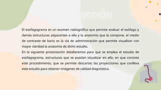 Esofragograma con contraste de bario.pptx
