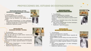 Esofragograma con contraste de bario.pptx