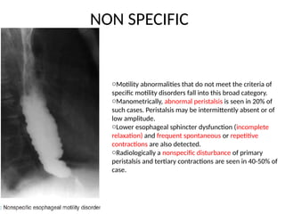 Esophageal motility disorder - Radiological imaging pptx | PPTX