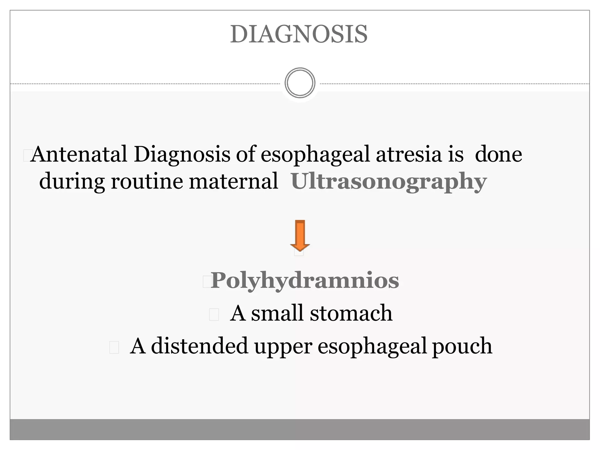 Esophageal atresia | PPTX