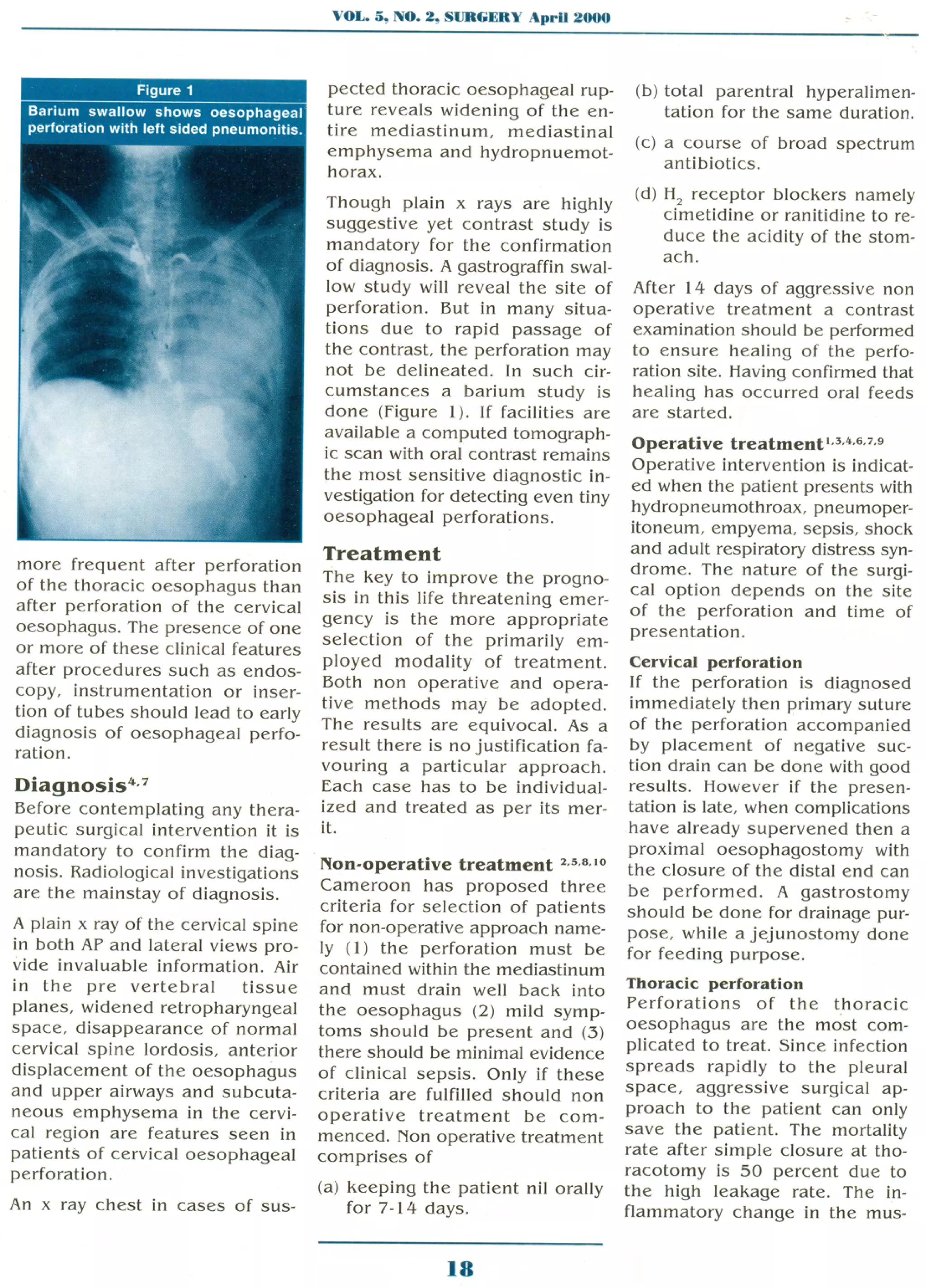 Esophageal Perforation | PDF