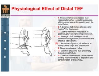 Esophageal atresia-- Epitome of modern surgery | PDF