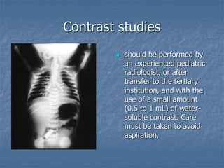Esophageal Atresia.ppt