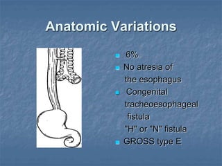 Esophageal Atresia.ppt