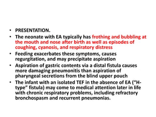 Esophageal Atresia and TOF.pdf