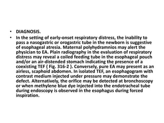Esophageal Atresia and TOF.pdf