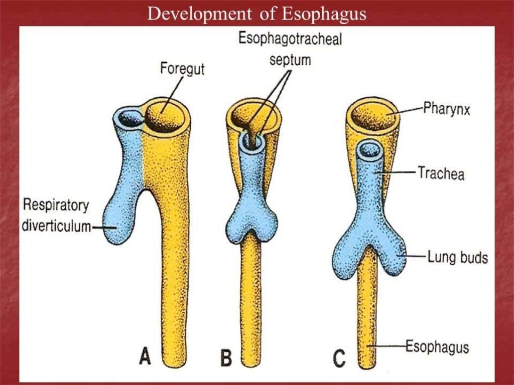 Esophageal atresia & tracheo-esophageal fistula