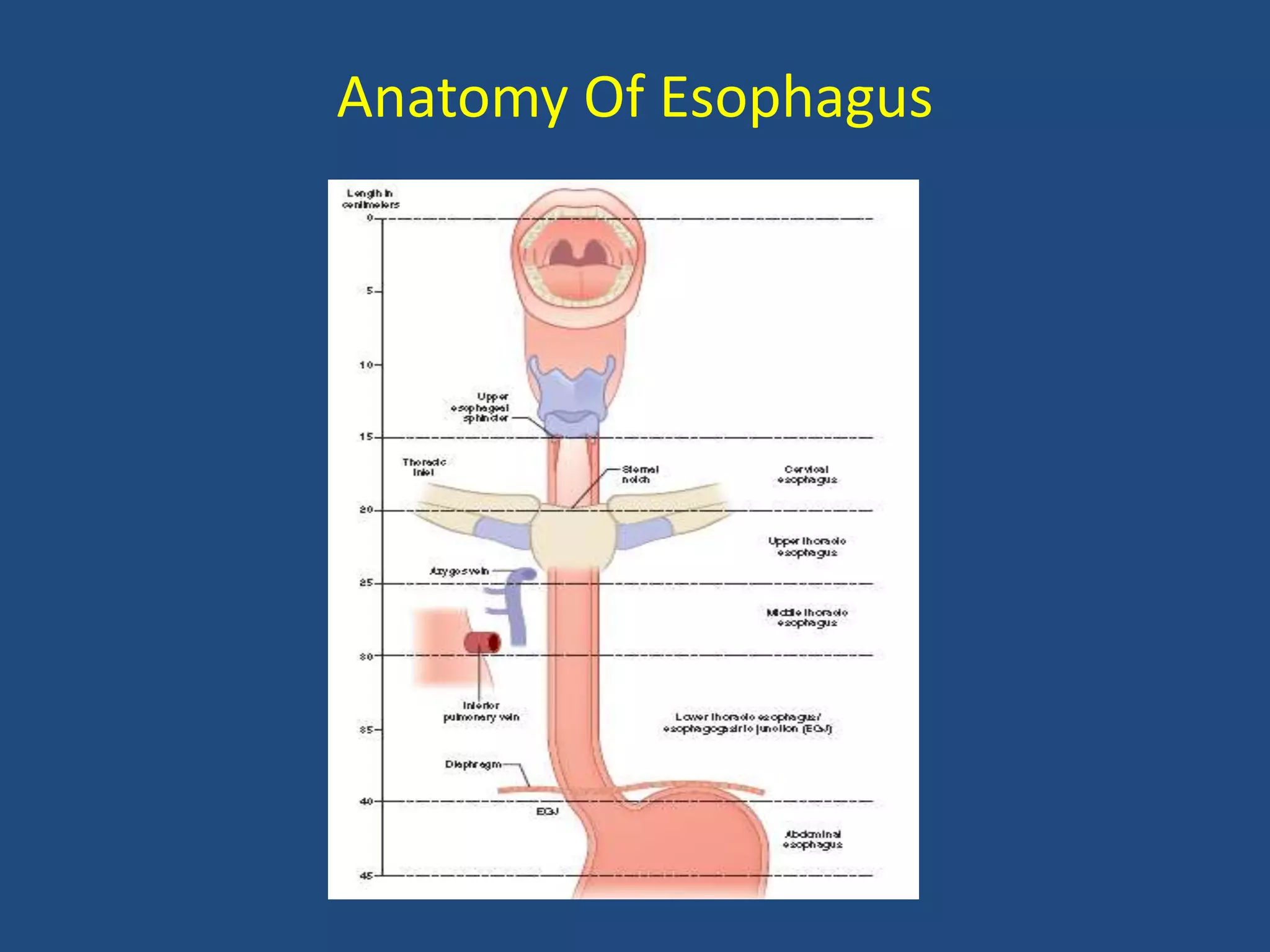 Esophageal ca | PPTX