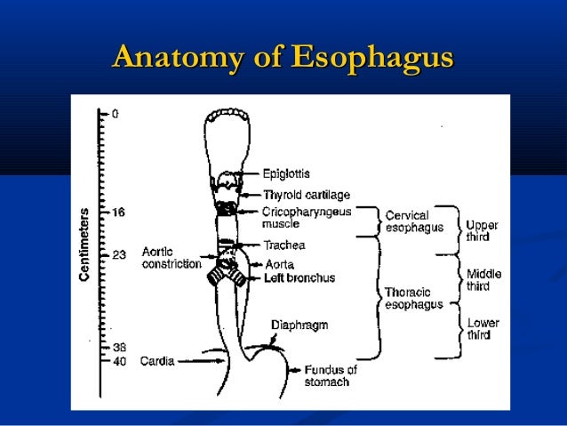 Esophageal cancer