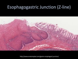 Gastroesophageal Junction Slide Labeled