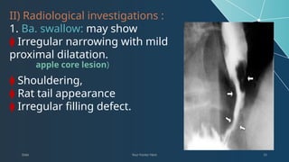 Presentation for esophageal cancer .pptx