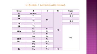 esophageal cancer staging.pptx