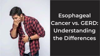 Understanding Esophageal Cancer and GERD: Expert Insights | PDF