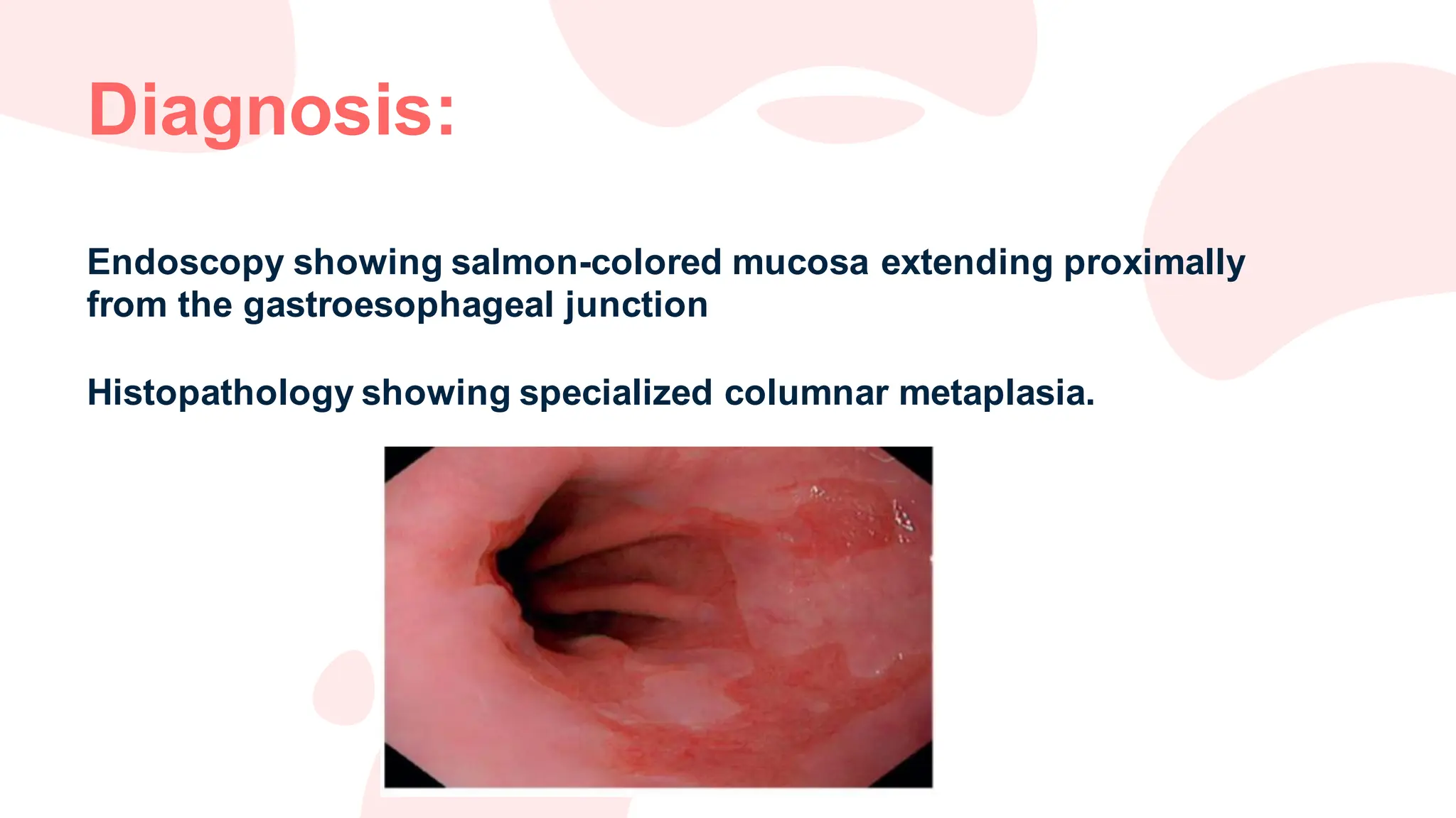 Esophageal diseases .pdf by university of kufa college of medicine | PPT