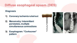 Esophageal diseases .pdf by university of kufa college of medicine | PDF
