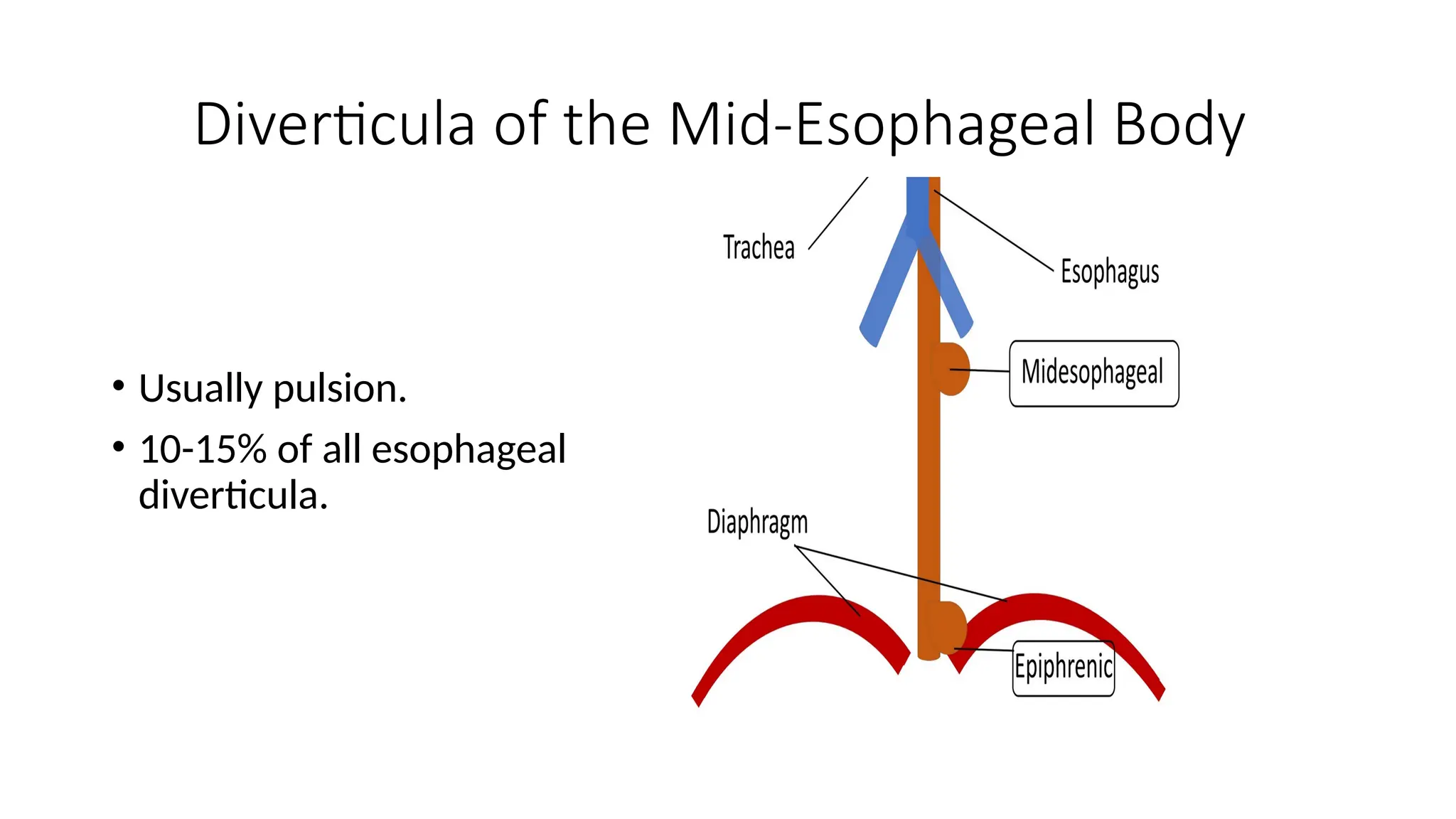 Esophago-pharyngeal Diverticula and their management | PPT