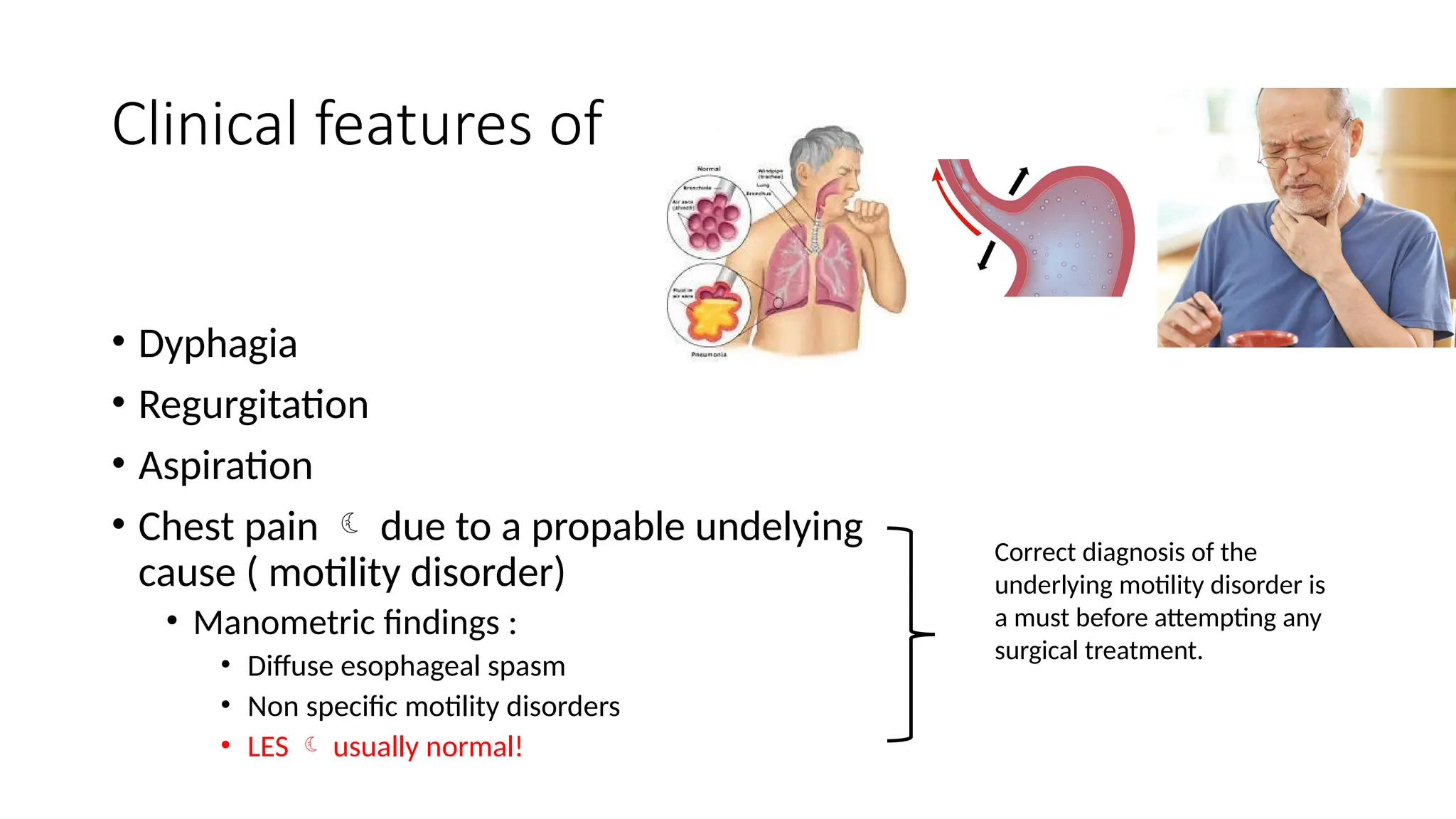 Esophago-pharyngeal Diverticula and their management | PPT
